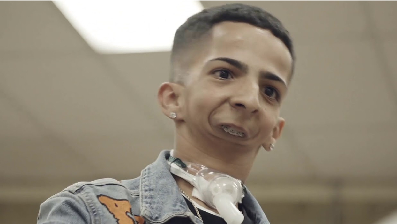 Isaiah Acosta, Pria Tanpa Rahang yang Tak Bisa Bicara tetapi Sukses ...