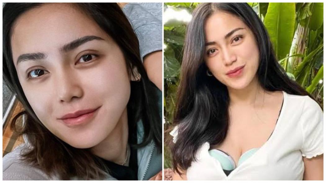 Penampilan Baru Jessica Iskandar Pasca Oplas Hidung di Korea Bikin ...
