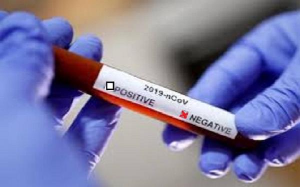 Ada-Ada Saja, 5 Oknum Anggota Polisi Ini Gunakan Surat PCR Palsu