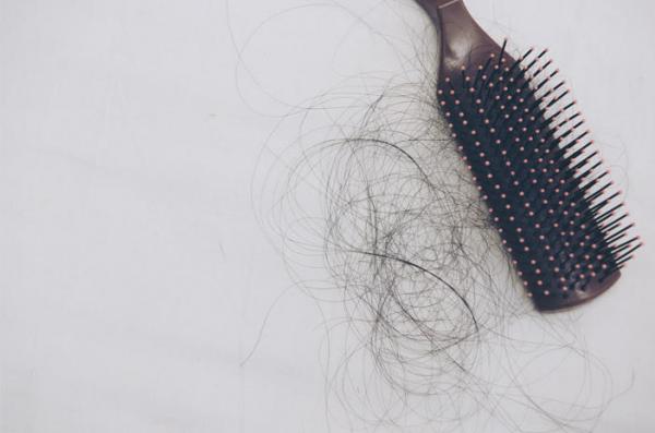Kenali 5 Penyebab Rambut Rontok dan Cara Mengatasinya