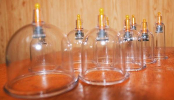 Mengenal Terapi Bekam, Pengobatan Alternatif Berusia Ribuan Tahun