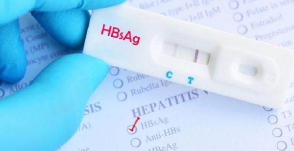 Mengenal Tes HBsAg Adalah untuk Deteksi Hepatitis B - Bagian 1