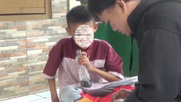 Bocah asal Purwakarta Kecanduan Aroma Bensin, Bupati Kirim Tim Medis