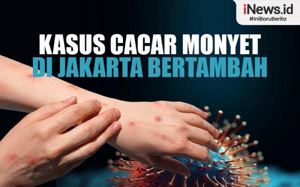 Infografis Kasus Cacar Monyet di Jakarta Bertambah