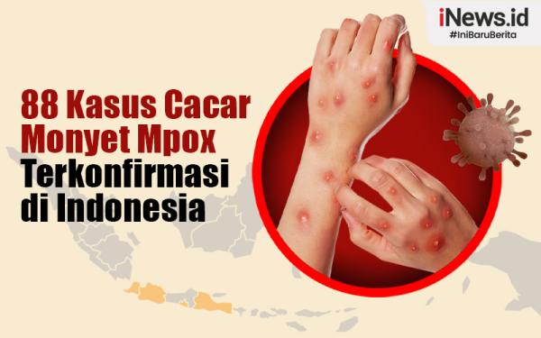 Infografis 88 Kasus Cacar Monyet Mpox Terkonfirmasi di Indonesia
