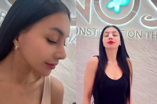 3 Fakta Denada Oplas: Transformasi, Alasan dan Biaya yang Mengejutkan