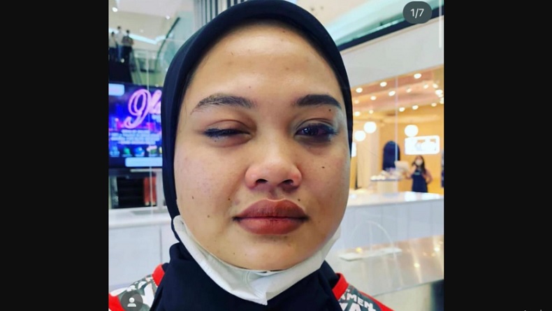 Viral Driver Ojol Pukul Karyawan Restoran di Jakbar, gegara Salah Ambil Orderan | News+ on RCTI+