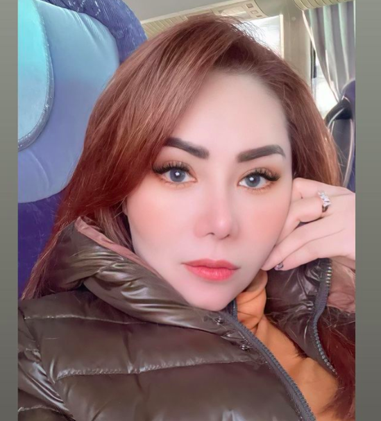 Deretan Artis Melakukan Suntik Botox Ada Yang Berusia 50 Tahun