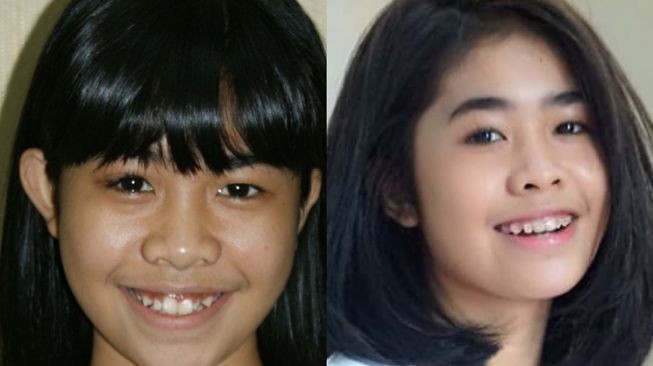 4 Potret Transformasi Alifa Lubis, Artis Cilik Multitalenta yang Kini ...